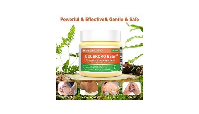 Heat Rash Cream, Eczema, Hand Foot Treat, Tinea Versicolor, Itchy Feet ...