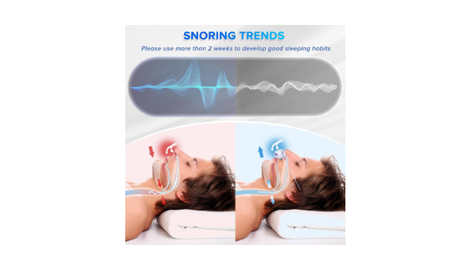 Anti Snoring Devices, 2024 Upgraded Electric Snoring Solution to Stop ...